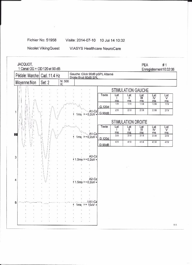 PEA/BAER (Potentiel Evoqué Auditif/Brainstem Auditory Evoked Response ...